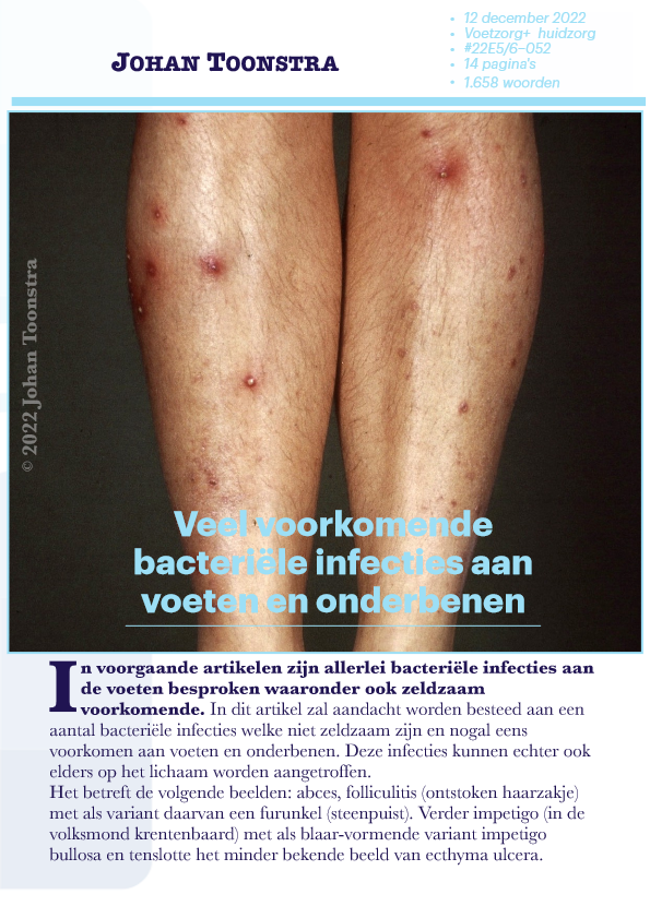 052 Veel voorkomende bacteriële infecties – Voetzorgplus